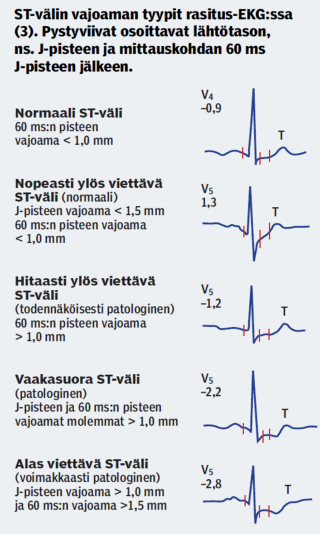 Diagnostiset tutkimukset – Siun Soten hoitopolut